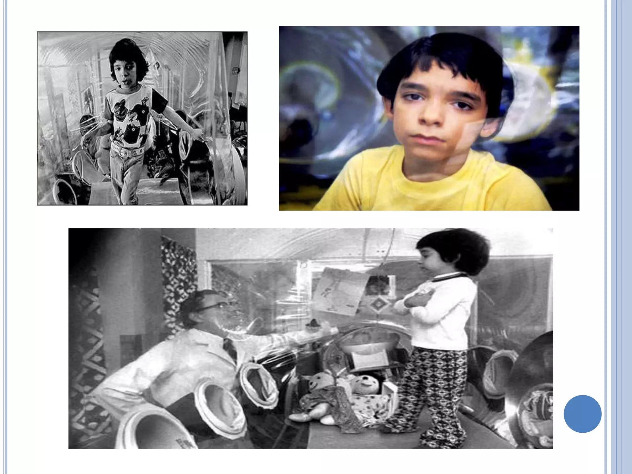 Severe combined immunodeficiency (scid) | PPTX