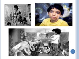 Severe combined immunodeficiency (scid) | PPT