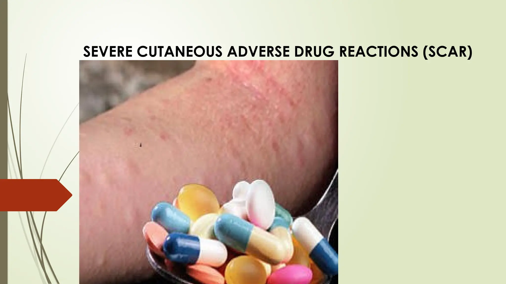 SEVERE CUTANEOUS ADVERSE DRUG REACTIONS (SCAR)-2-1.pptx