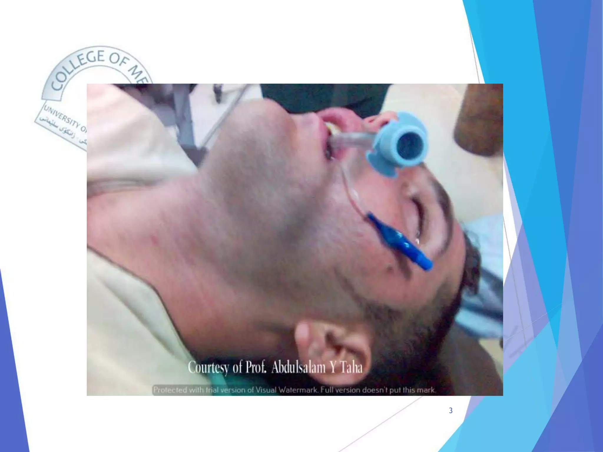 Severe Dysphagia due to Food Bolus Impaction in a Young Man.pdf