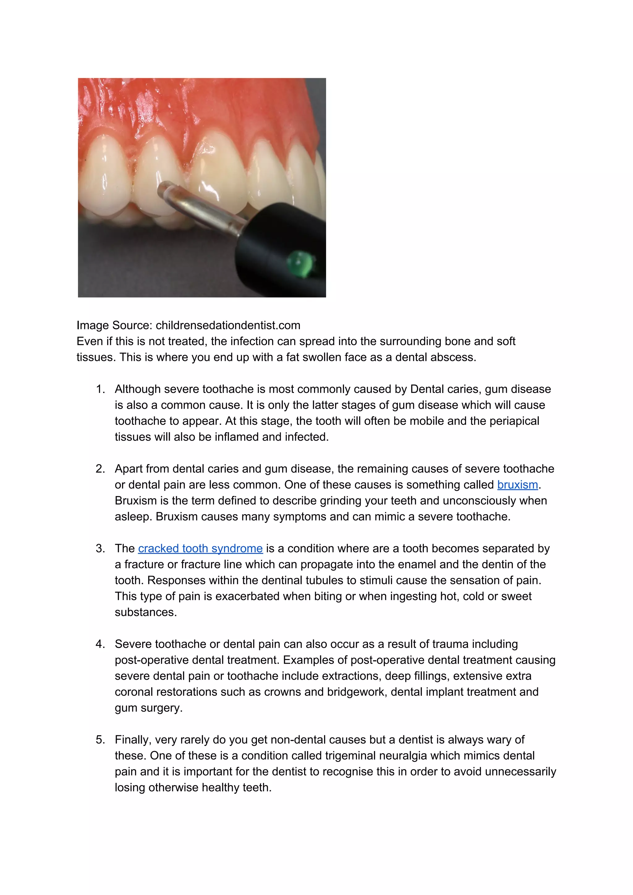 Severe Toothache and Dental Pain. | PDF