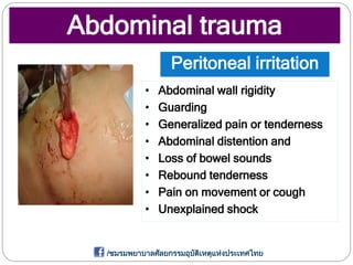 Severe trauma and traumatic shock 14 พค.58