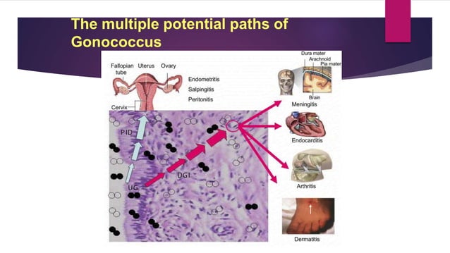 Genital Skin Lesions | PPTX | Sexual Conditions | Sexual Health