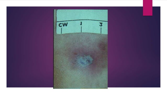 Genital Skin Lesions | PPTX | Sexual Conditions | Sexual Health