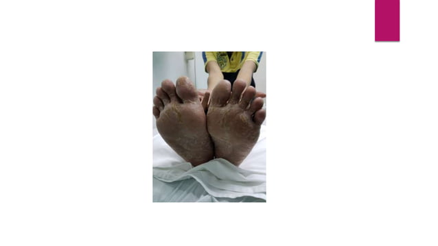 Genital Skin Lesions | PPTX | Sexual Conditions | Sexual Health