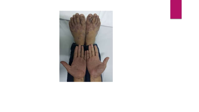 Genital Skin Lesions | PPTX | Sexual Conditions | Sexual Health