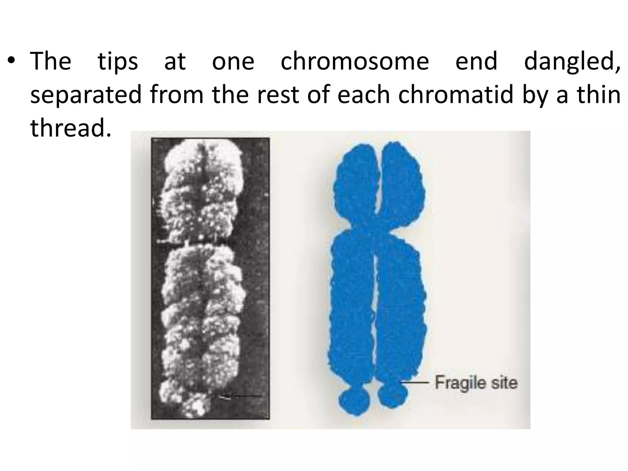 Sex chromosome disorders | PPTX