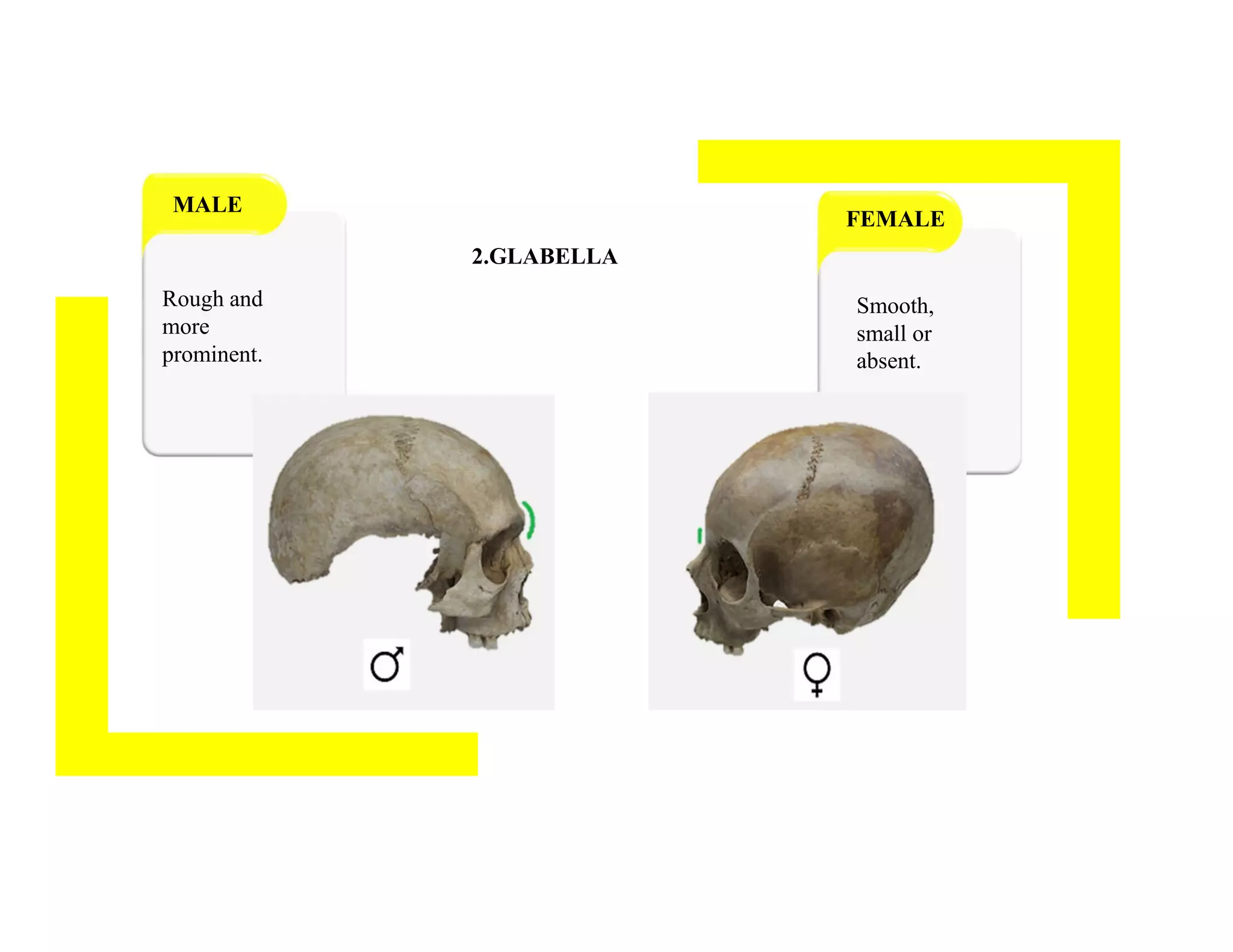 Sex Determination From Skull Ppt