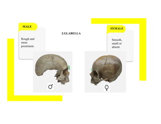 Frontonasal Junction