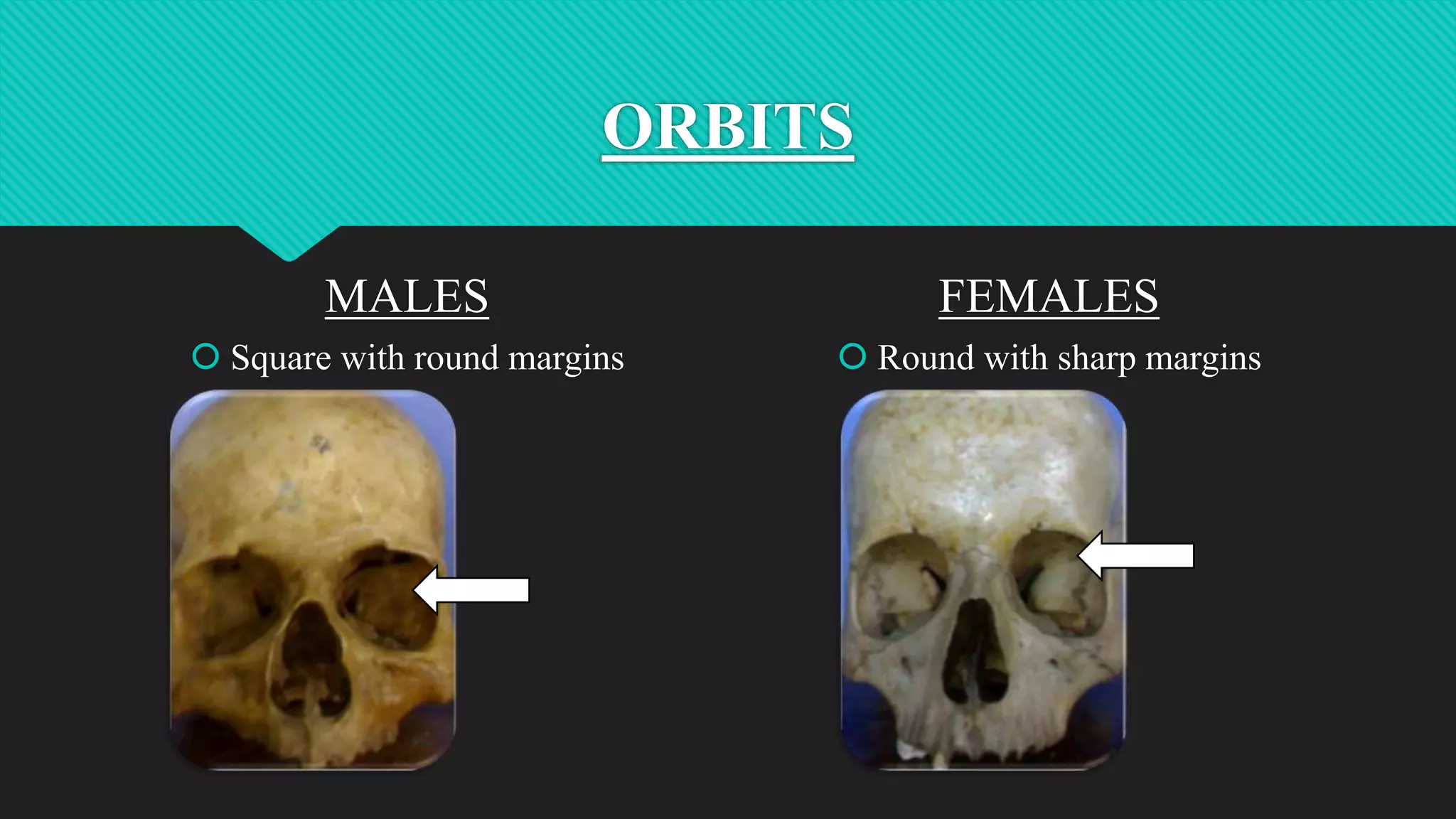 Sex determination from skull and mandible | PPTX