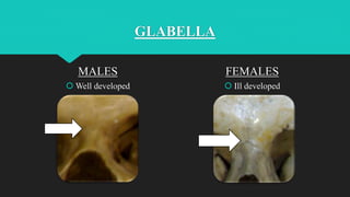 Sex determination from skull and mandible | PPTX