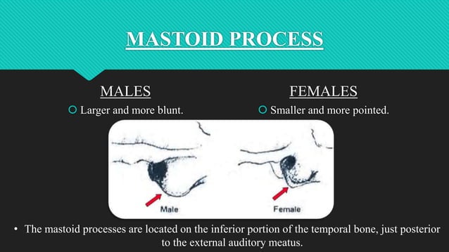Sex Determination From Skull And Mandible