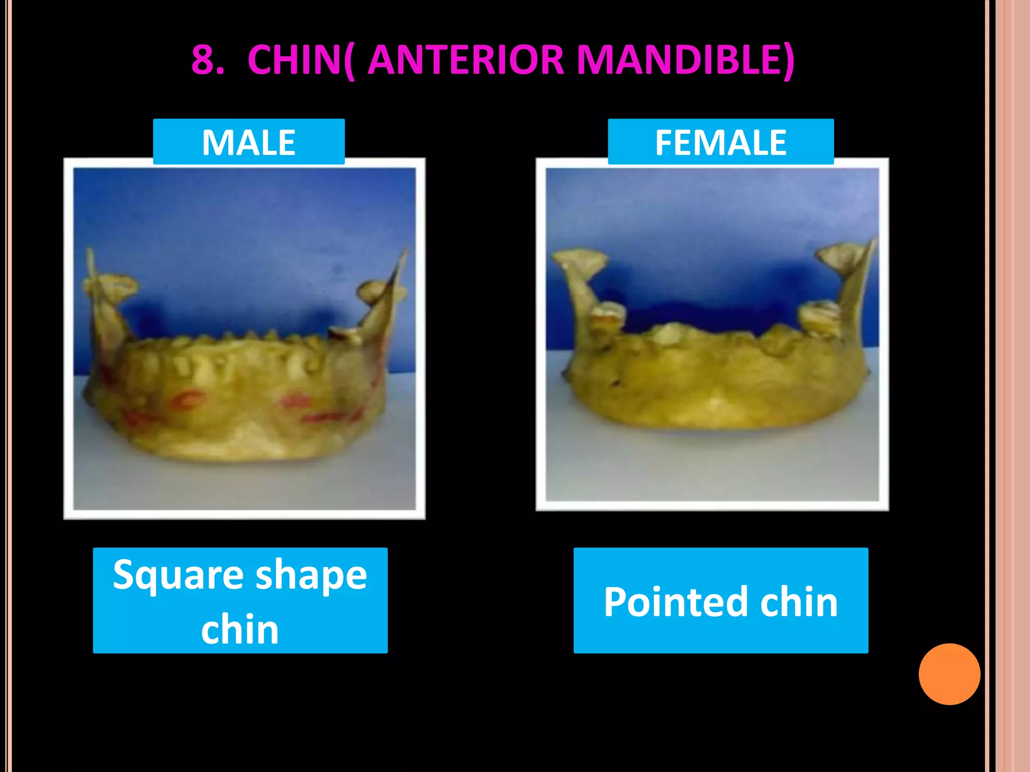 Sex Determination In Forensic Pptx