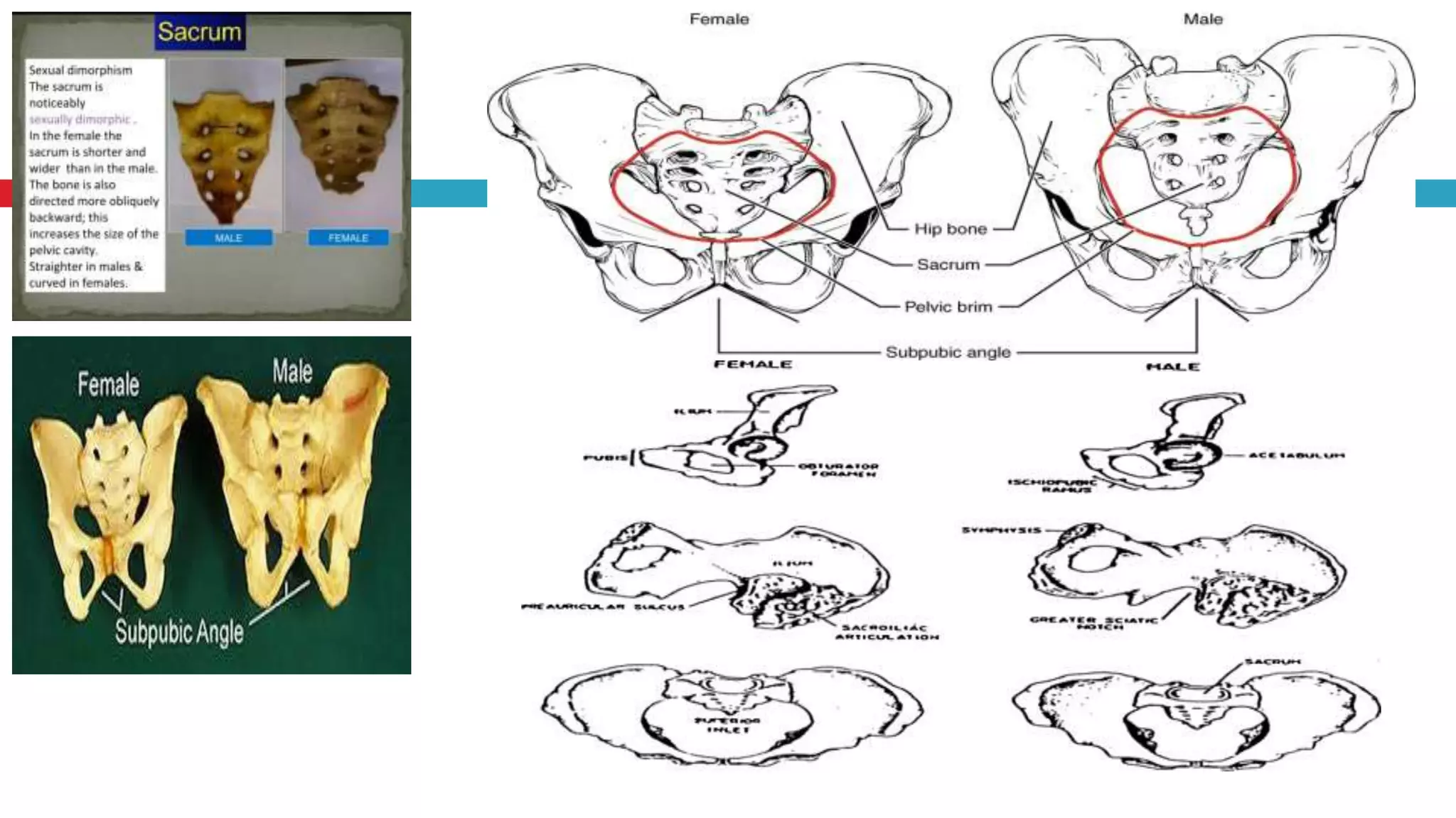 Sex Determination Using Anthropometric Methods Pptx Bone And Joint