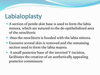 Sex change surgery | PPTX