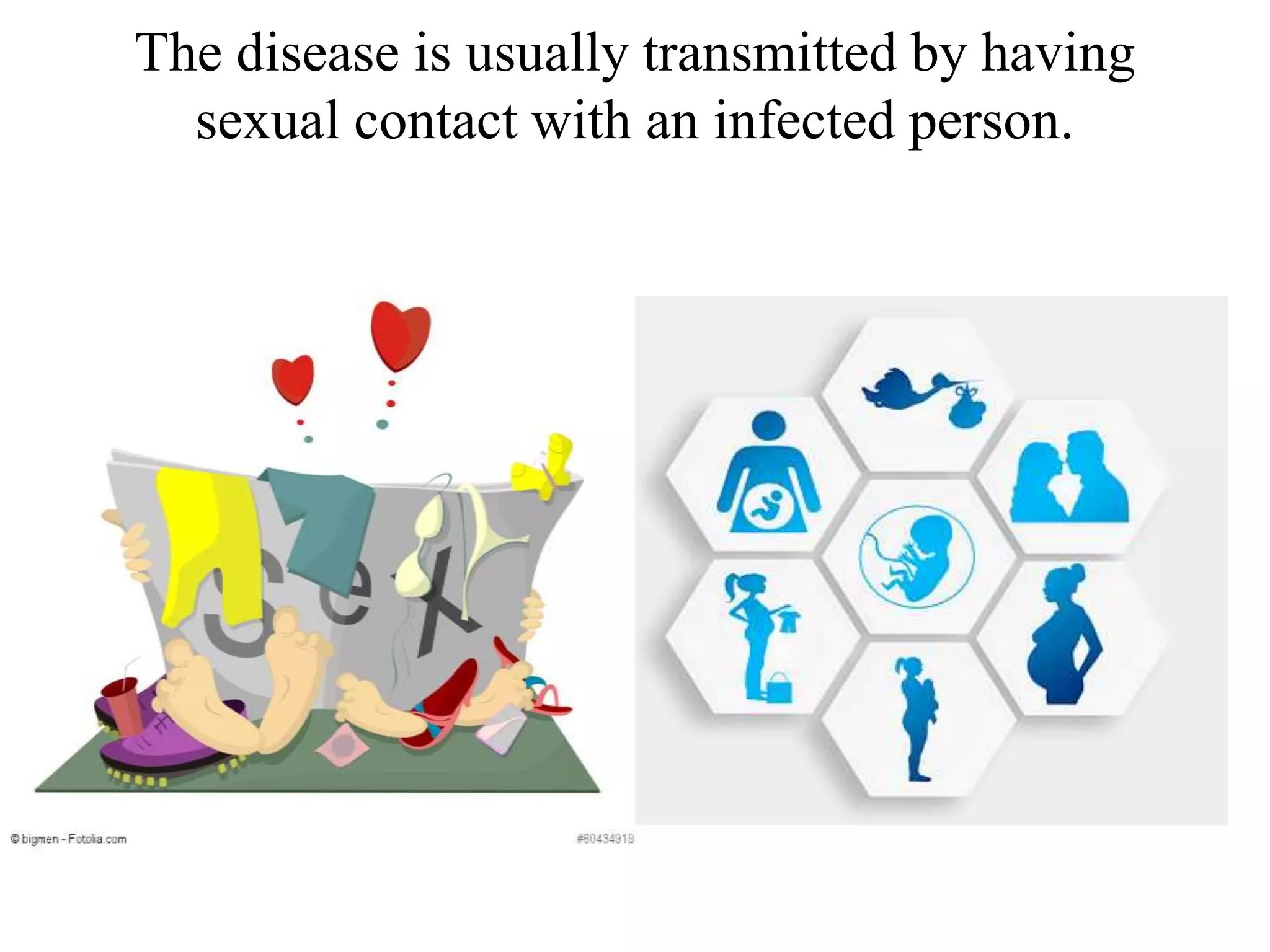Sexually transmitted disease(SYPHILIS) | PPTX