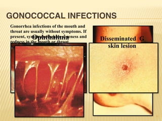 Sexually transmitted diseases | PDF | Sexual Conditions | Sexual Health