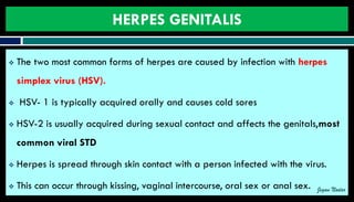 Pathophysiology of Sexually transmitted diseases | PDF