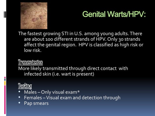 Sexually transmitted diseases (st is) 201211987 | PPTX