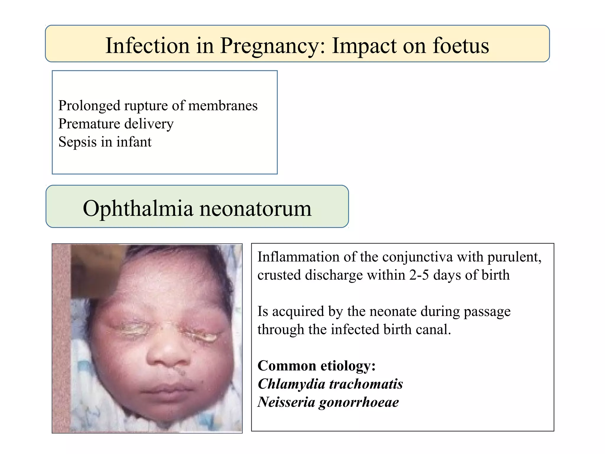 Sexually transmitted infections | PPT