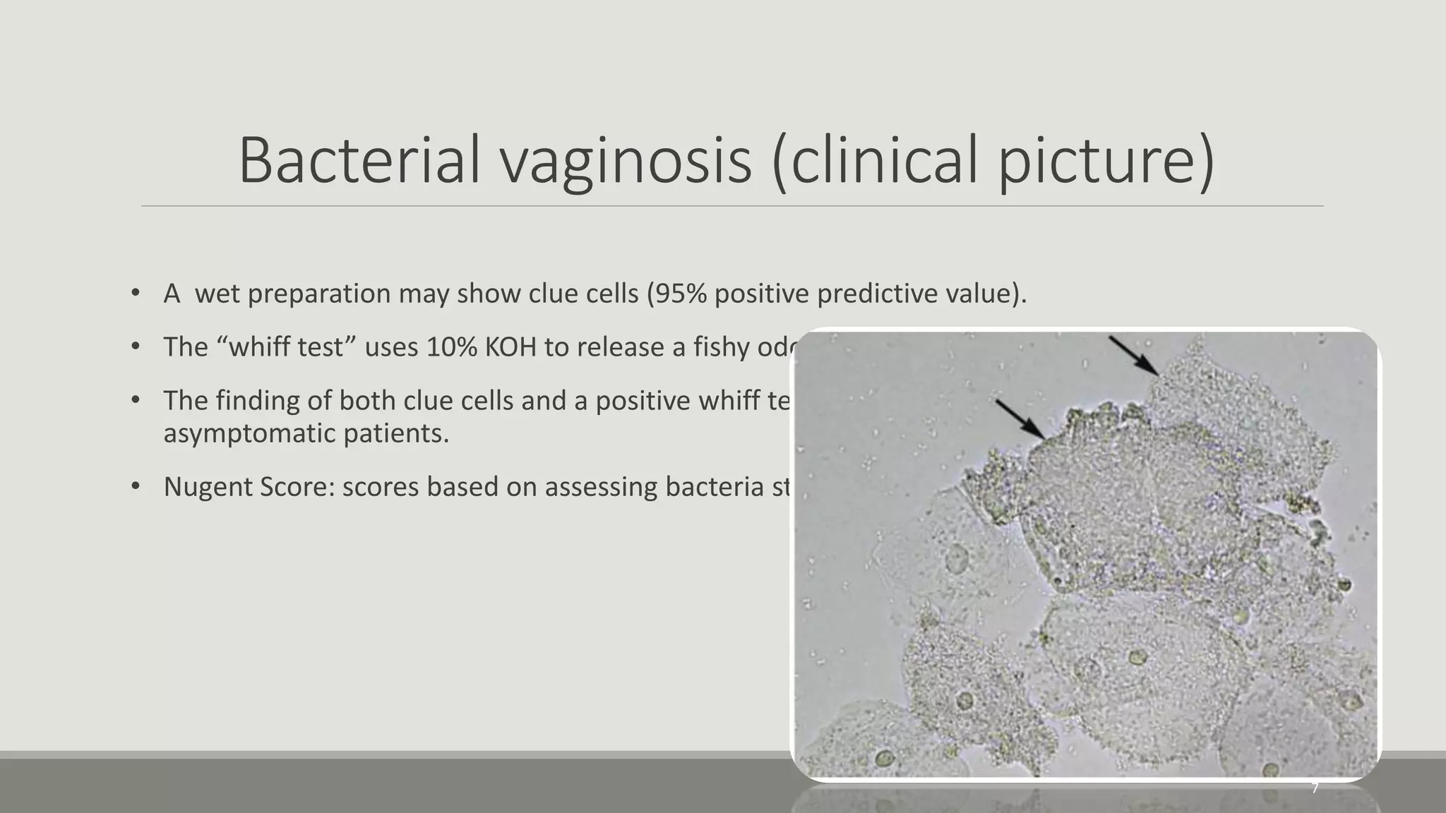 Sexually transmitted infections and pelvic inflammatory disease | PPTX