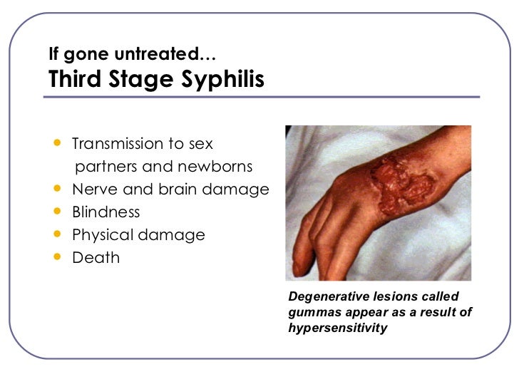 Sexually Transmitted Infections