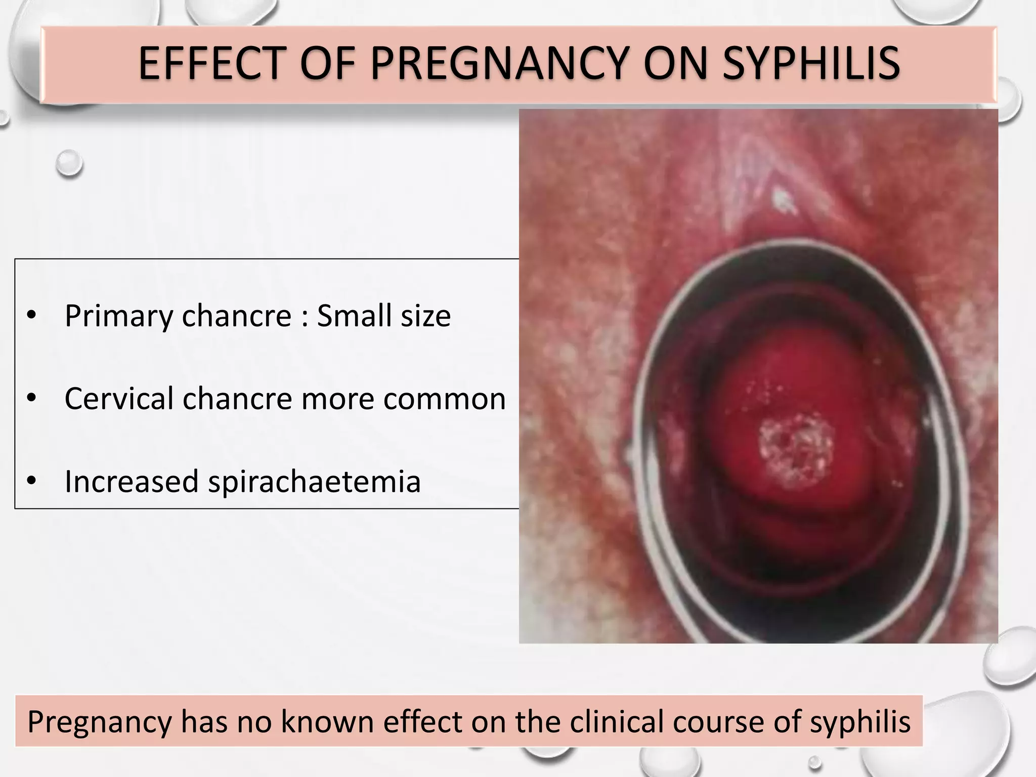 Sexually Transmitted Infections In Pregnancy Pptx