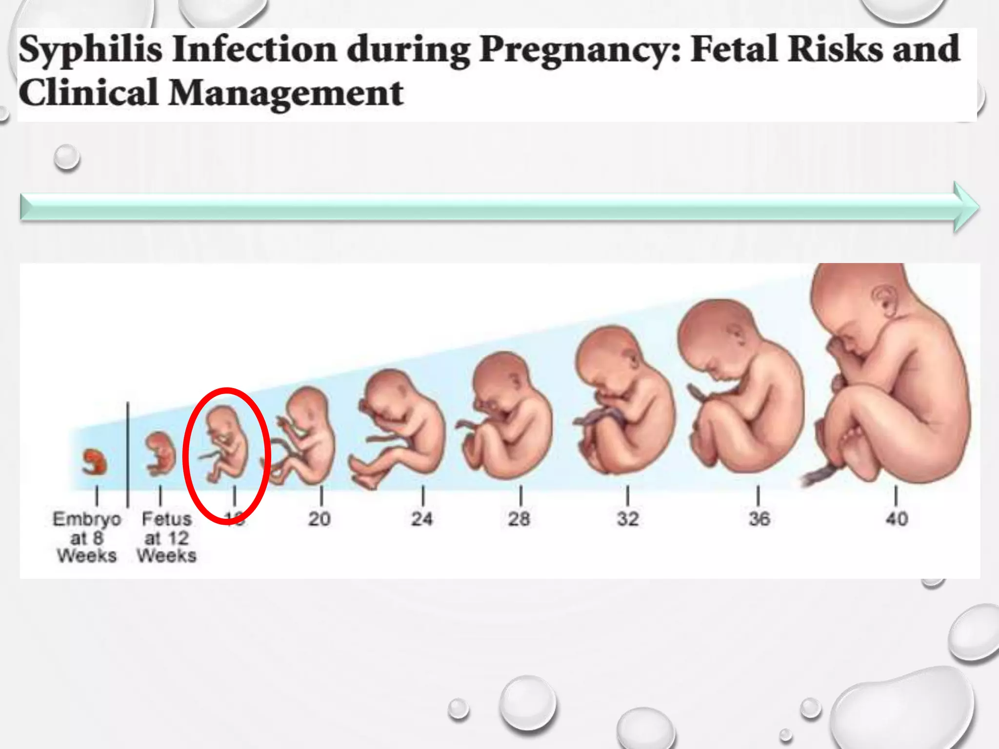 Sexually transmitted infections in pregnancy | PPTX
