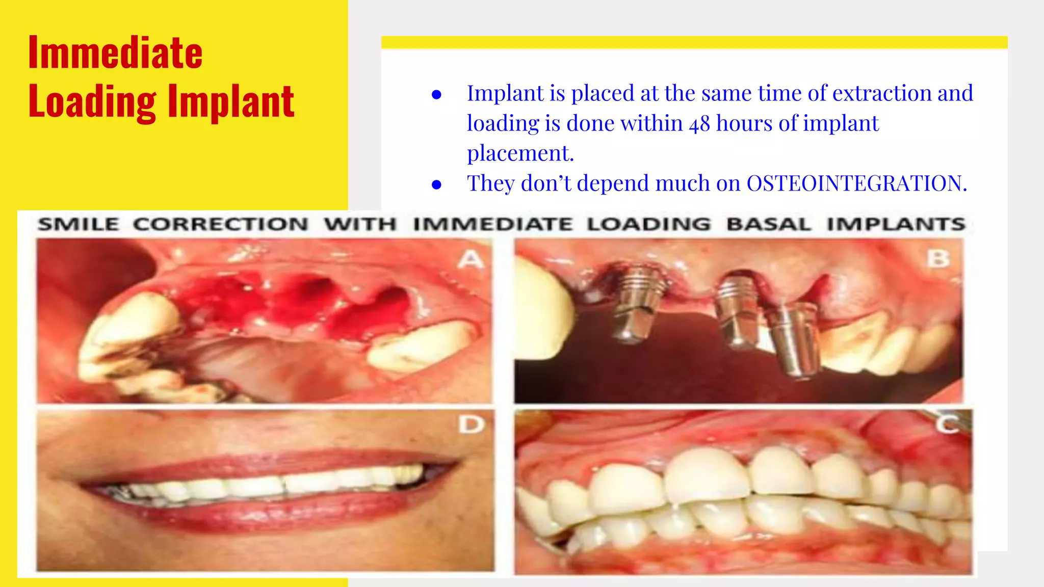 Osteointegration_of_Implant.pptx