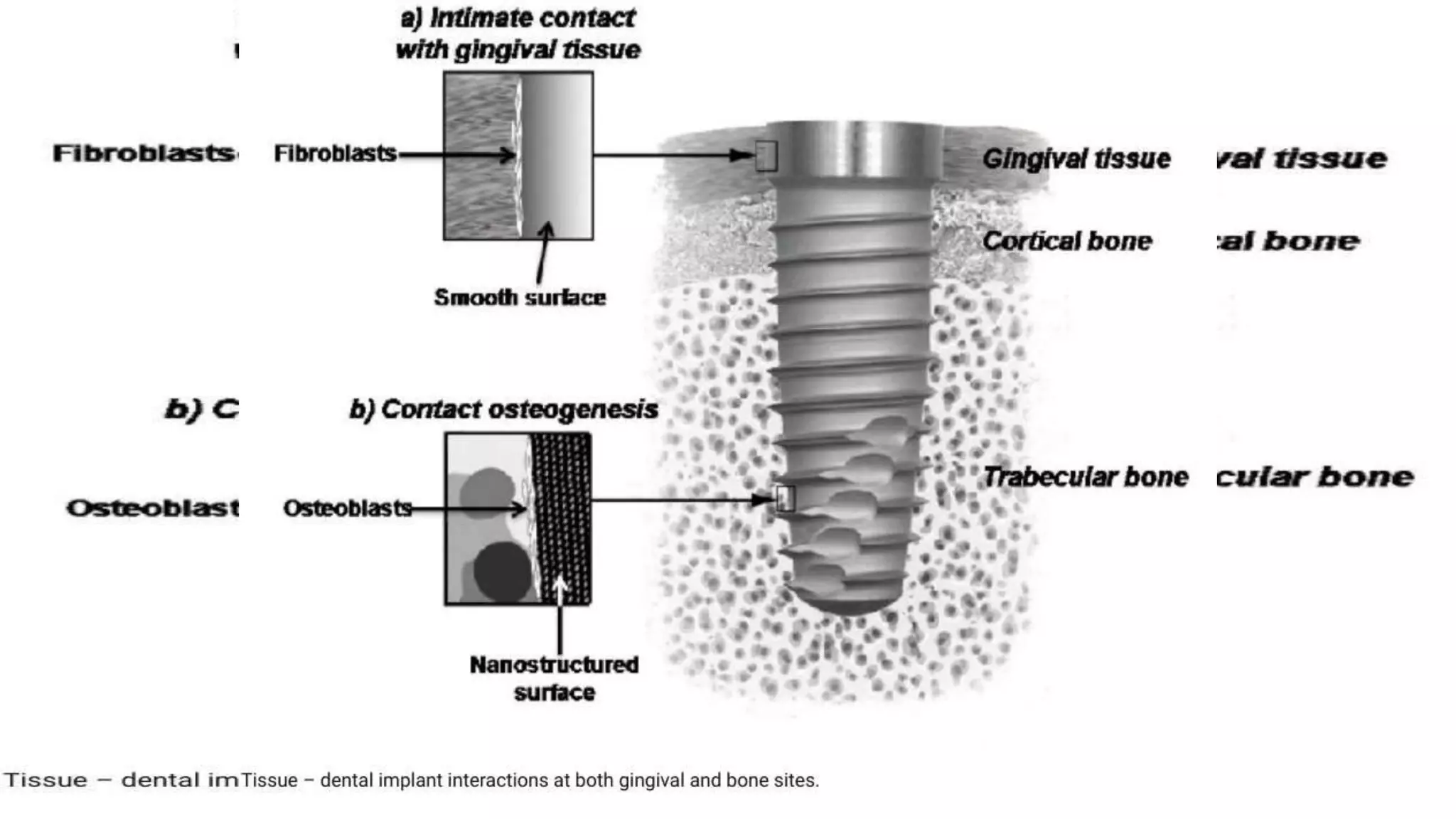 Osteointegration_of_Implant.pptx