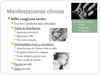 Sífilis congénita. miriam nova. febrero 2014 | PPT