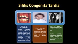 Sífilis congénita | PPTX