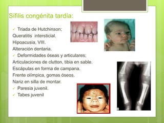 Sífilis congénita expo | PPTX