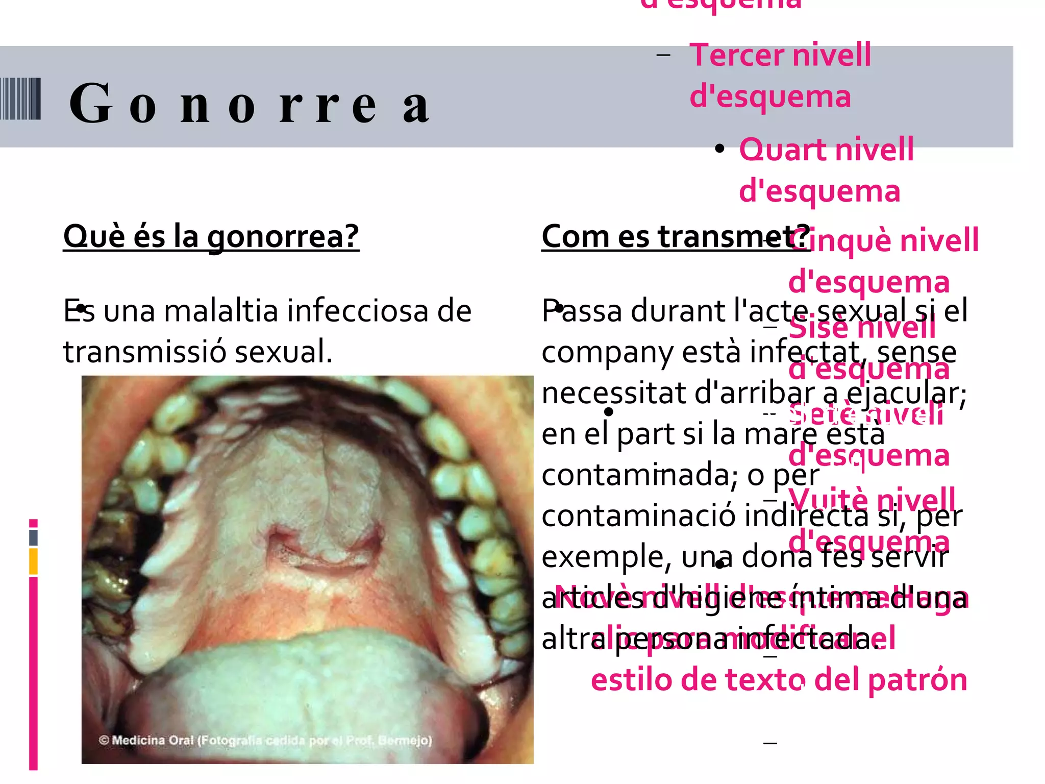 SíFilis I Gonorrea | PPT