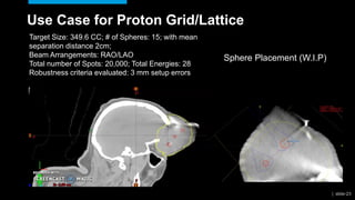 SG-SFRT The use of surface imaging for spatially fractionated ...