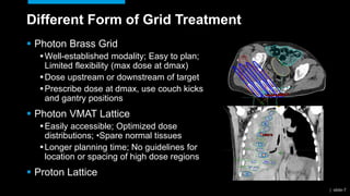 SG-SFRT The use of surface imaging for spatially fractionated ...