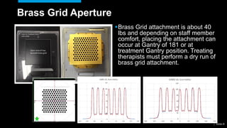 SG-SFRT The use of surface imaging for spatially fractionated ...