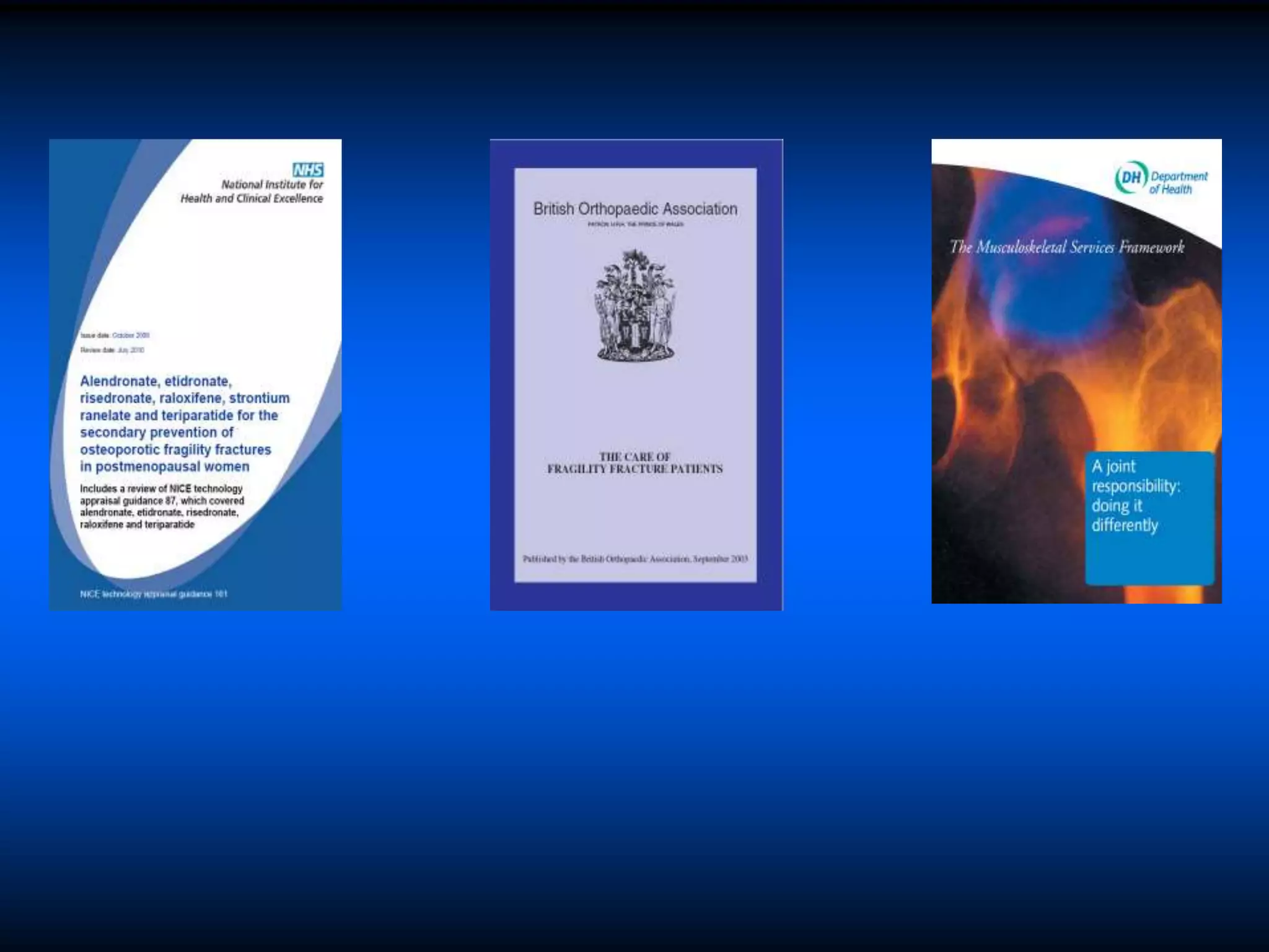 Management Of Osteoporosis: Prevention Of Fragility Fractures In ...