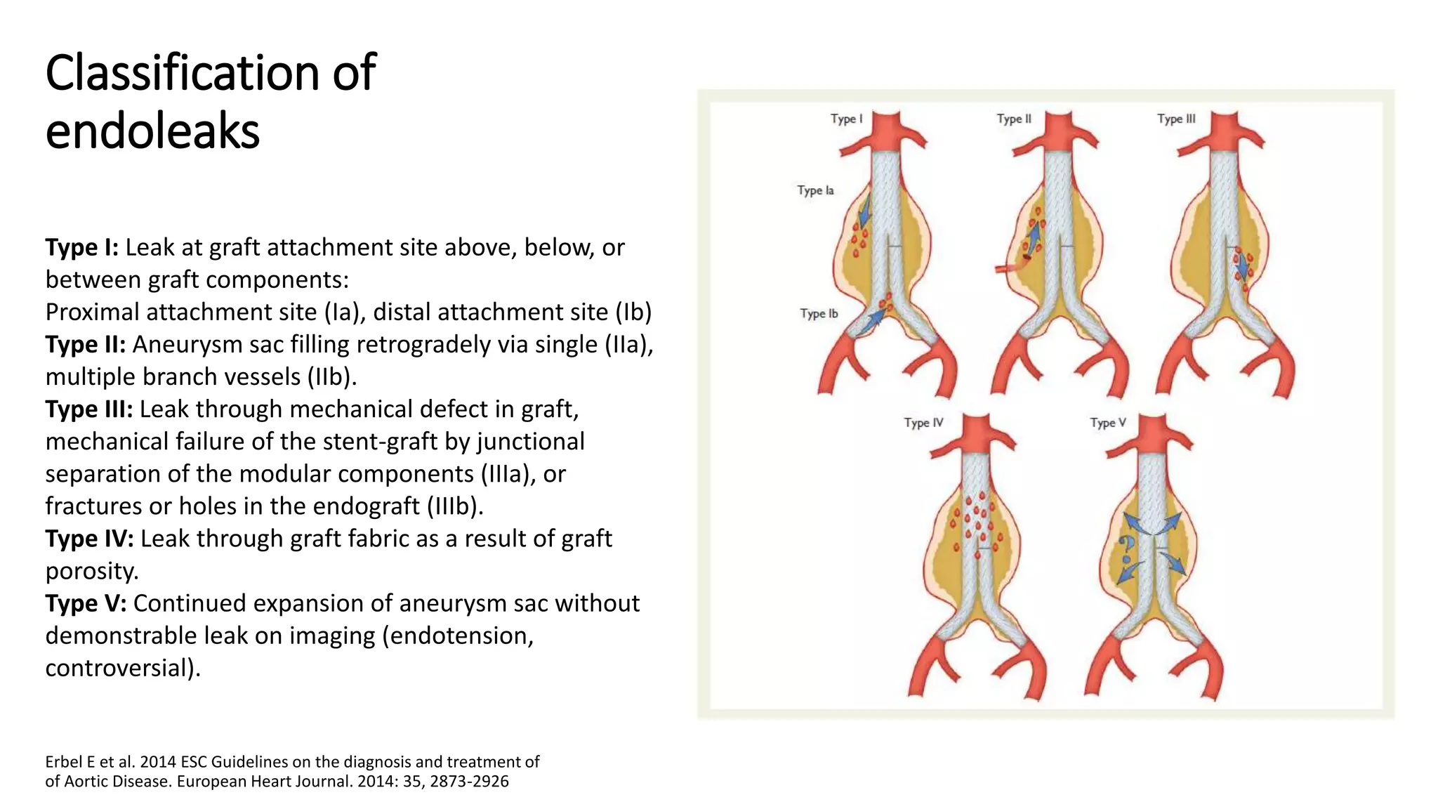 SG Aortic Disease.pptx