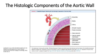SG Aortic Disease.pptx | Heart and Cardiovascular Diseases | Diseases ...