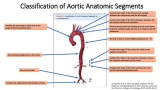 SG Aortic Disease.pptx