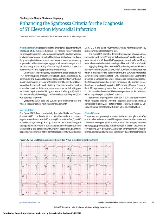 Sgarbossa criteria for the diagnosis of st elevation myocardial ...