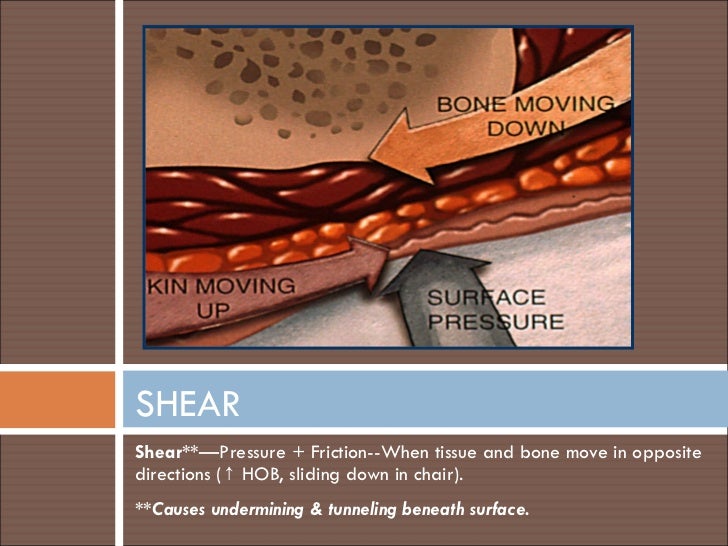 Sg chpn hpna week 3 symptom management