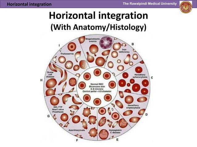 SGD_Hemoglobin adn Hemoglobionopathis_ Iron Metabolism Corrected by ...