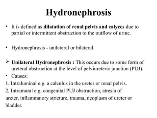 SGD renal stones, hydronephrosis renal system pptx | PPTX