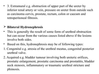 SGD renal stones, hydronephrosis renal system pptx | PPTX