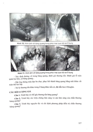 SGK Chấn thương bàng quang Y4.pdf rất hay | PDF