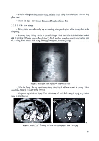 SGK Chấn thương bụng Y4.pdf rất hay nha các bạn | PDF