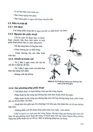 SGK Giãn đại tràng bẩm sinh ở trẻ em.pdf