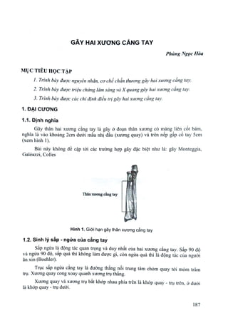 SGK Gãy hai xương cẳng tay Y4.pdf rất hay | PDF